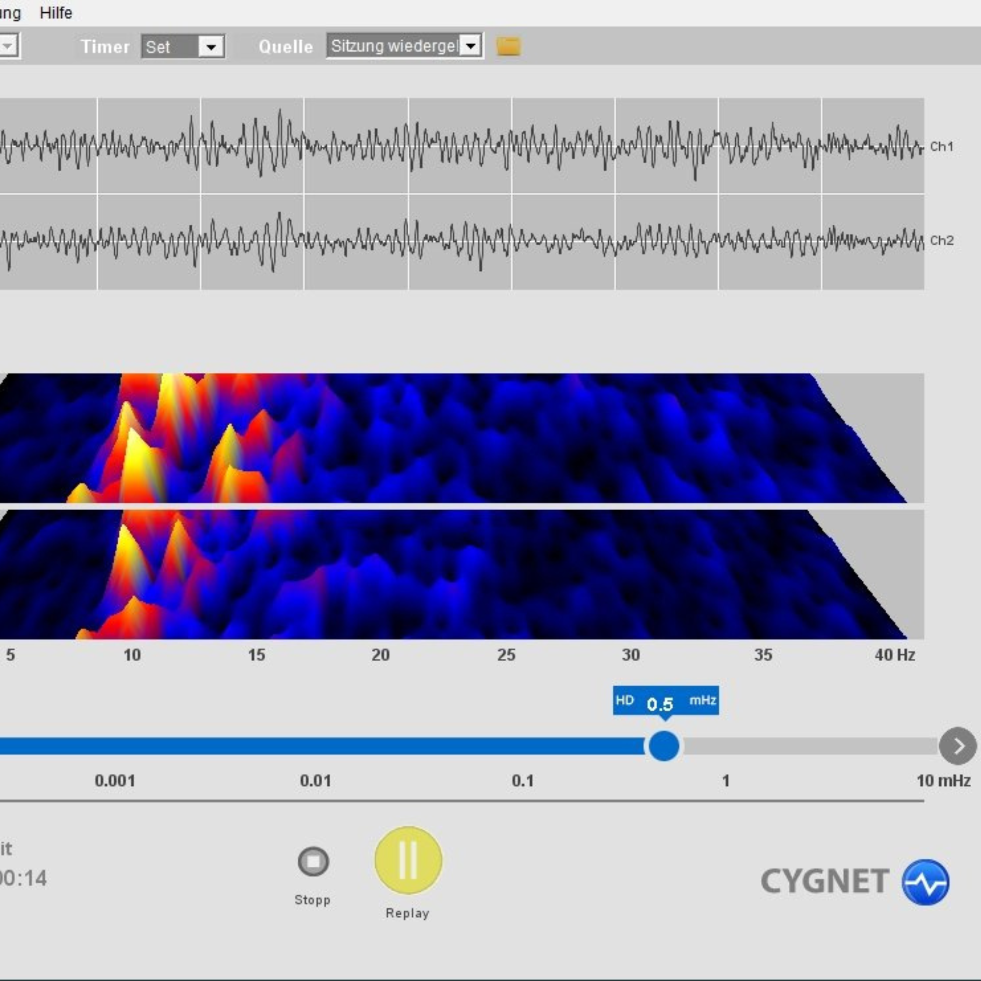 NeuroAmp | BEE Medic